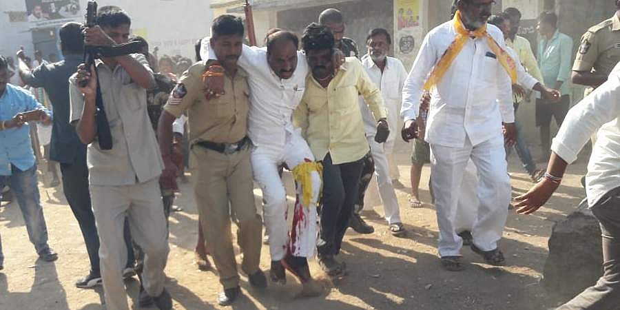 TDP's Mantralayam candidate Thikka Reddy injured in clash with YSRC MLA ...