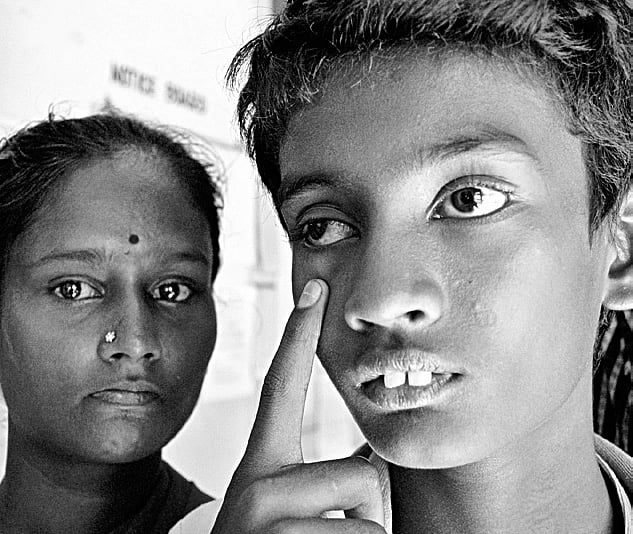 14-year-old loses sight in alleged police torture