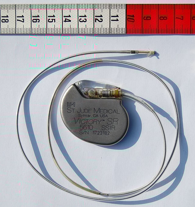 Patients Try Out Pacemaker Outside the Skin Before Committing to ...