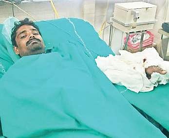 Severed palm reattached by performing surgery