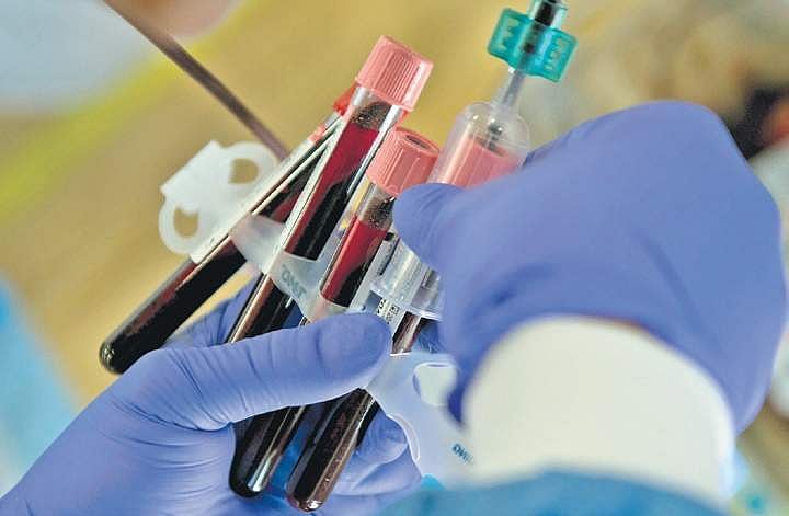 Genetic testing helps reduce risk of cardiac issues