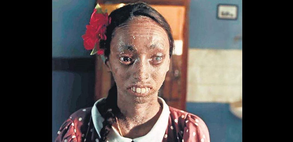 Cannes win for film on adopted Bengaluru girl with special needs