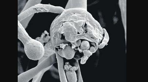 Explainer: As black fungus reaches TN, experts emphasise early ...