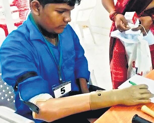 ‘Limbs on Wheels’ gives lifelong free prosthesis to the needy
