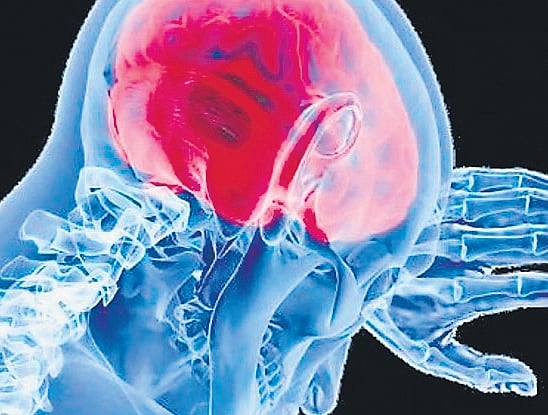 Kerala has advanced facilities to detect amoebic brain fever: Public health lab