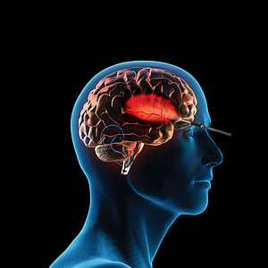 Brain-computer interface: NHS to test mood enhancement treatment amid ...