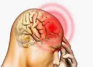 Pneumococcal bacterial infection: What it is and how to prevent related ...