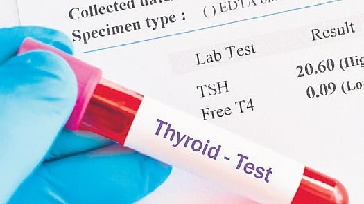 Study shows women more prone to abnormal thyroid levels