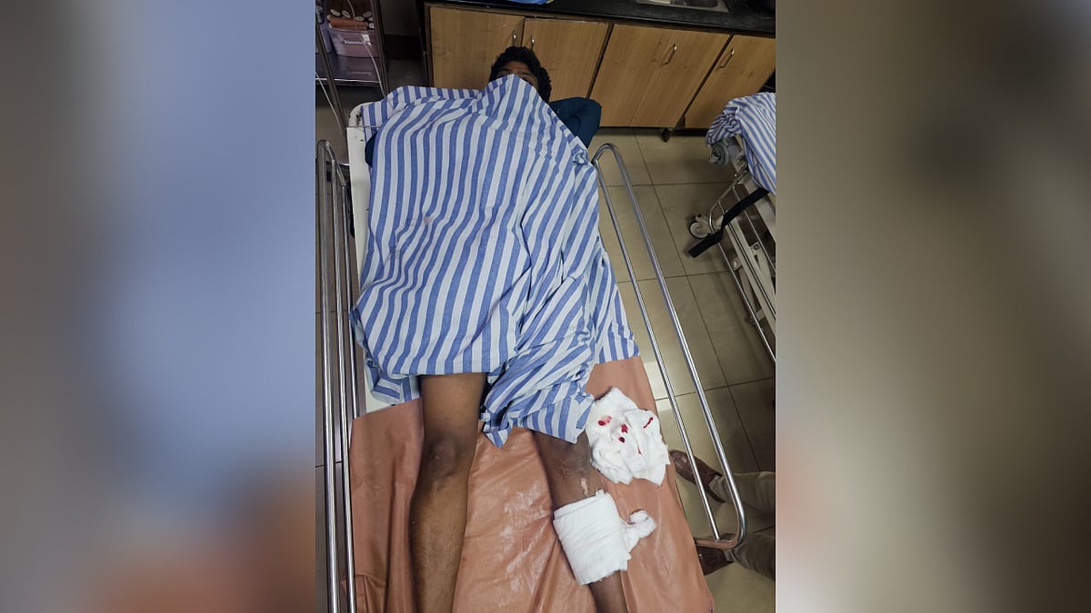 Kotekar dacoity case key accused shot while attempting escape during ...