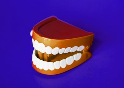 When oral cancer mimics a simple ulcer: Rare tongue cancers that delay ...