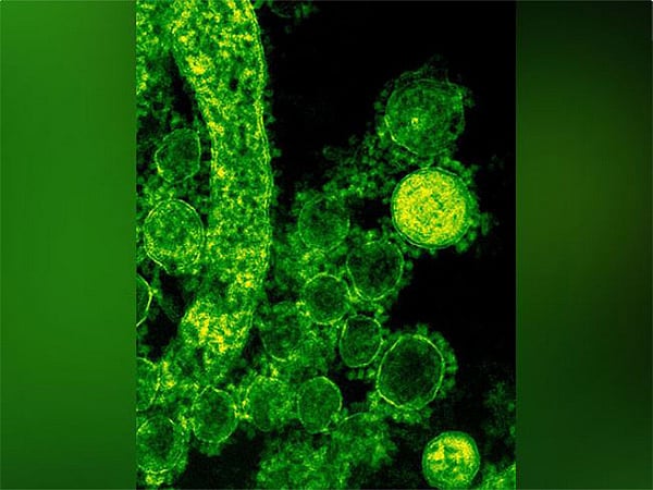 Nipah Virus Alert: Suspected Cases Detected in West Bengal, Centre ...